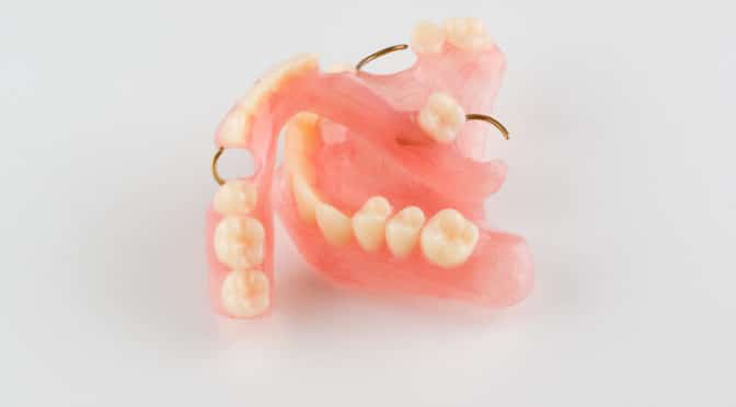 Partial Dentures | Acrylic, Flexible, Metal, Overdentures | Smile ...